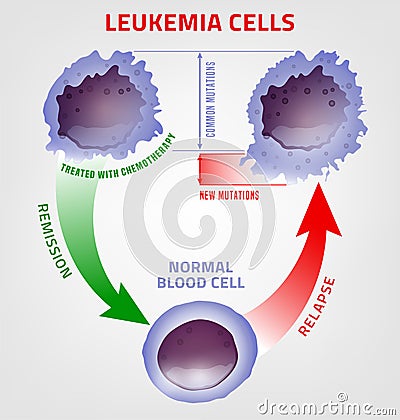 Leukemia Medical Infographic Cartoon Vector | CartoonDealer.com #138420865