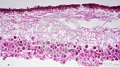 Lichen Section Under Microscope 400x Against Bright Field for Education ...