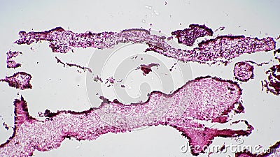 Lichen Section Under Microscope 100x for Educational Issues and ...