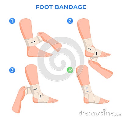 Limb Bandaging Step-by-step Instructions. Help With Leg Injuries ...