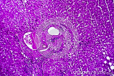 Liver Edema, Light Micrograph Royalty-Free Stock Photography ...