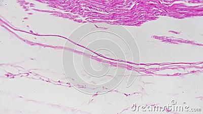 Longitudinal Section of Human Being Nerves Trunk Under Microscope 200x ...