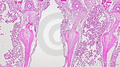 Longitudinal Section of Human Lung Filmed Under Microscope 100x Against ...