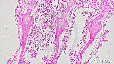 Longitudinal Section of Human Lung Filmed Under Microscope 200x Against ...