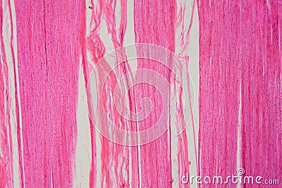 Longitudinal Section Of Human Nerve Cells Under The Microscope Royalty ...