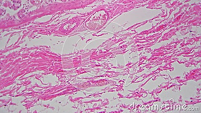 Longitudinal Section of Kidney Magnified Under Microscope 400x on ...