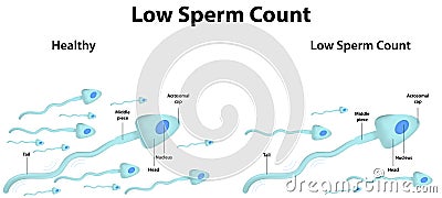 Low Sperm Count Stock Vector - Image: 41897840