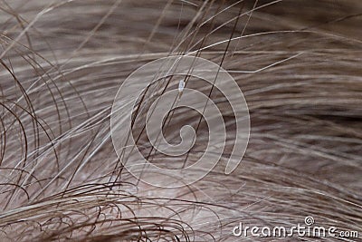 Luizen Royalty-vrije Stock Foto - Afbeelding: 23263385