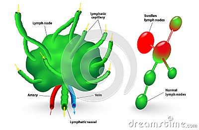 Lymfeknoop Stock Foto - Afbeelding: 31036390