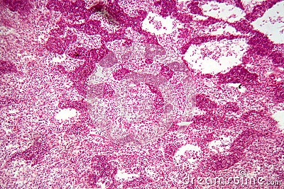 Lymph Node Cells Under The Microscope. Royalty-Free Stock Image ...