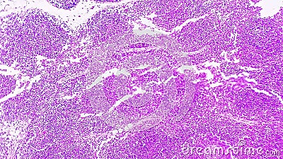 Lymph Node in Section Filmed Under Microscope 100x on Bright Field ...