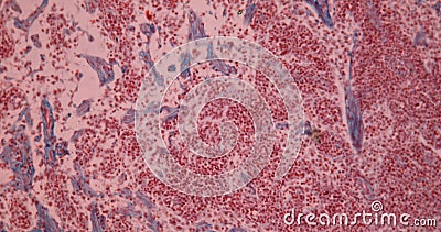 Lymph Nodes in Cross Section Stock Video - Video of glands, secretion ...