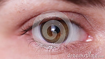 Macro Eye Photo. Keratoconus - Eye Disease, Thinning of the Cornea in ...