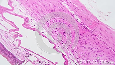Macro View of Human Bone Cells Under Microscope 200x Against White ...