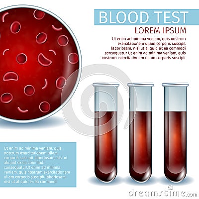 Hematology Medical Banner, Copy Space. Blood Test Cartoon Vector ...