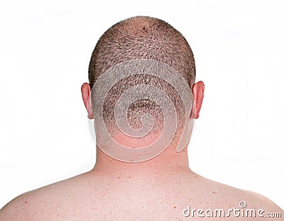 Male Head Close Up From Behind Stock Images - Image: 14951964