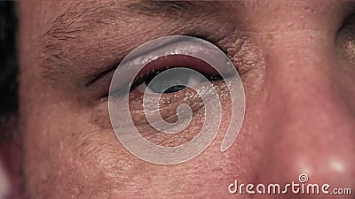 Man with infected eye stock footage. Video of skin, externum - 65768146