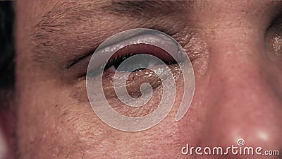 Man with infected eye stock footage. Video of skin, externum - 65768146