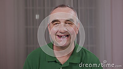 The Man Teeth Fell Out, Yellow and Black Teeth Hurt. Poor Teeth ...