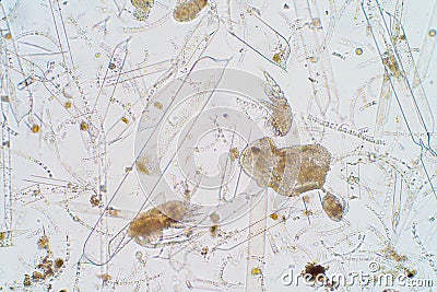 Marine Aquatic Plankton Under Microscope View Royalty-Free Stock Photo ...