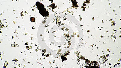 Micro Animal Water Bear Moves Quickly in Dirty Water from Moss Under a ...