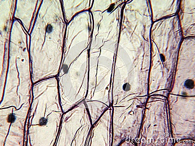 Micrograaf Van Ui Epidermale Cellen Stock Foto - Afbeelding: 78876664