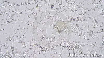 Microorganisms in water. stock video. Video of closeup - 261522521