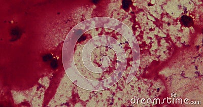 Bacteria Under a Microscope in a Hospital Stock Footage - Video of cell ...