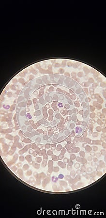 Microscope Image Of Canine Blood Cells Royalty-Free Stock Photography ...