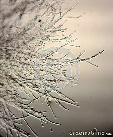 Dermatophyte Fungus Under The Microscope Stock Photo | CartoonDealer ...