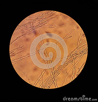 Microscope View Of Fungi Mycelium Filaments 40x Increase Royalty-Free ...