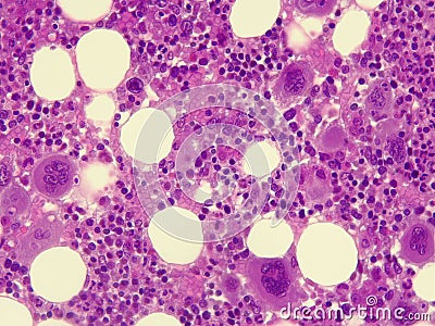 Microscopic Image Of Human Bone Marrow 400x Royalty-Free Stock ...