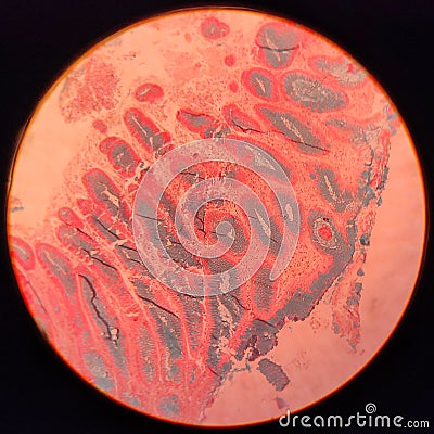 Microscopic Image Of A Human Tissue Stain Slide. Histology Stain ...