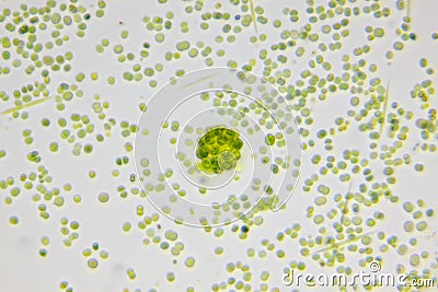 Microscopic View Of Colonial Green Algae Coelastrum Between Single-cell ...