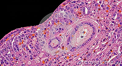 Microscopic View Of Human Lymph Node Cortex Medulla And Follicles ...