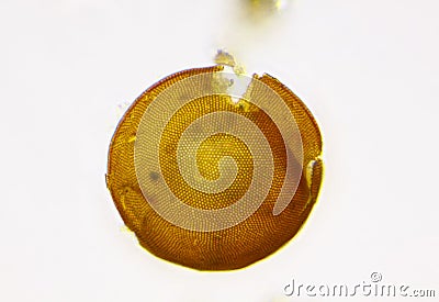 Microscopic View Of Testate Amoeba Arcella Shell With Visible External ...