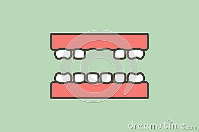 Missing Tooth, Space Between Teeth - Dental Cartoon Vector Flat Style ...