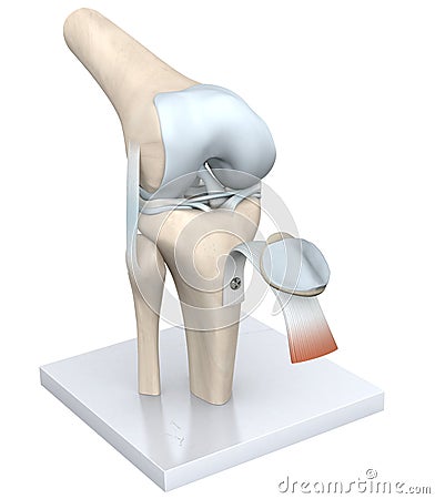 Model Of A Healthy Knee Joint. Bones, Cartilage, Ligaments And Meniscus ...