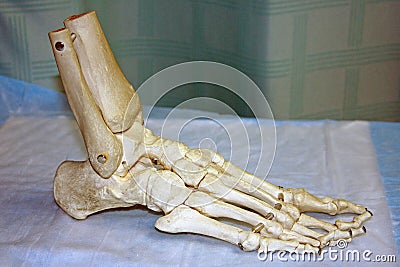 Right Hand with Simian Crease Stock Image - Image of fingers, ring ...