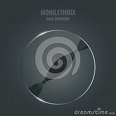 Monilethrix Hair Brittle Disorder In Close Up Vector Illustration ...