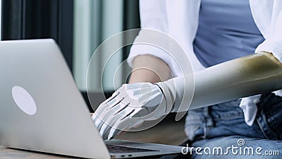 Motivated Woman Using Prosthetic Arm Working or Learning Notebook ...