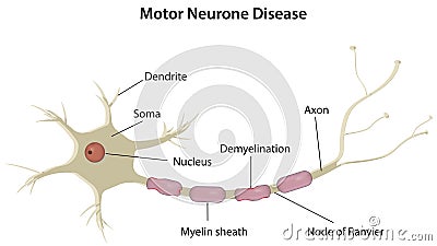 Motoneurone Illustration de Vecteur - Image: 41162003