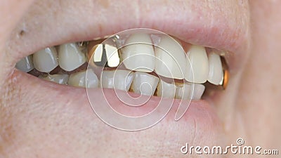 Mouth of Elderly Woman with False Teeth Stock Video - Video of mouth ...