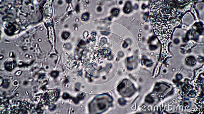 Moving Lactobacillus Acidophilus and Bifidobacteria in Yogurt Under a ...