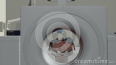 Mri Stock Footage & Videos - 4,165 Stock Videos