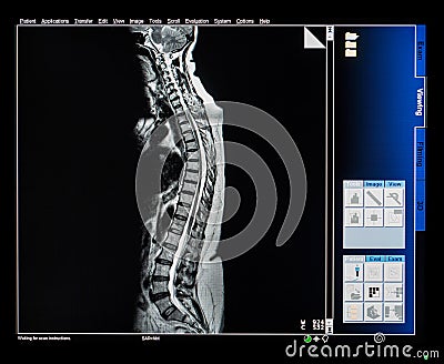 Mri Scan Monitor Royalty-Free Stock Photography | CartoonDealer.com ...