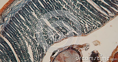 Muscles of the Earthworm in Cross Section Stock Video - Video of glands ...