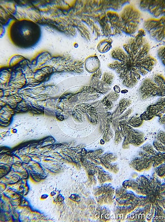 Bacillus Subtilis Beautiful Bacterial Growth Under The Microscope ...