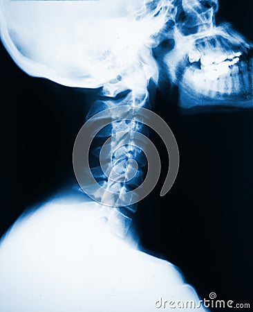 Xray/Face side stock image. Image of health, disease, diagnosis - 198831