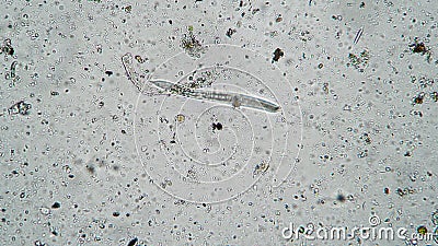 The Nematode Worm Moves among Numerous Clusters of Bacteria and ...